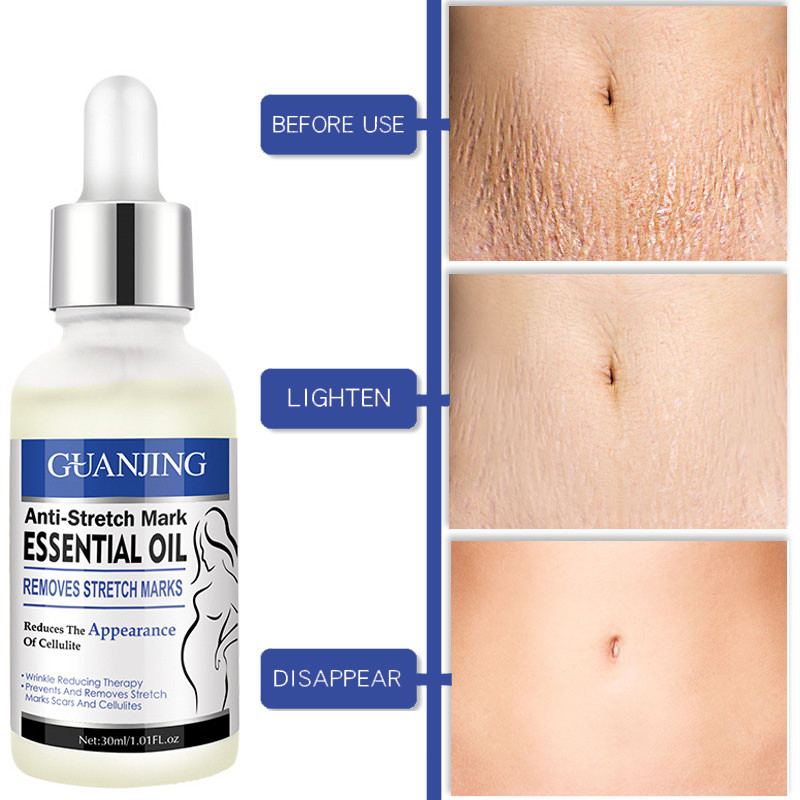 Guanjing Anti-Stretch Mark Essential Oil - 30ml | onide.lk